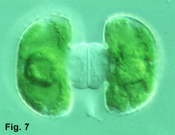 Diatom and Desmid Identification by Shape and Texture - the DIADIST project